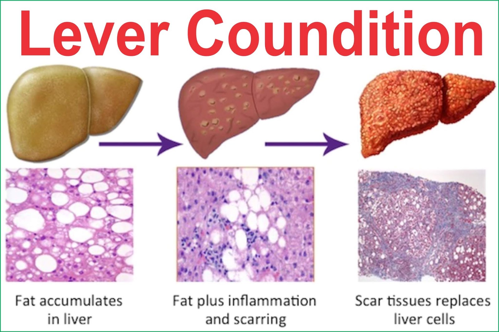 Lever Problem - Galaxy Clinics