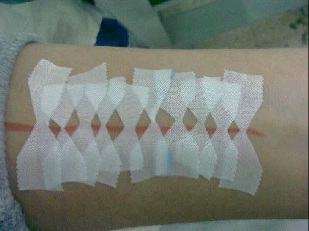 Reading Journal: Suturas y Vendoletes