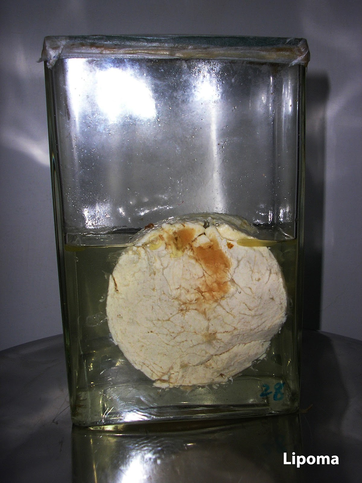 Medical Education for Students: Gross Specimens General Pathology (50 ...