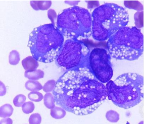 Platelets Definition