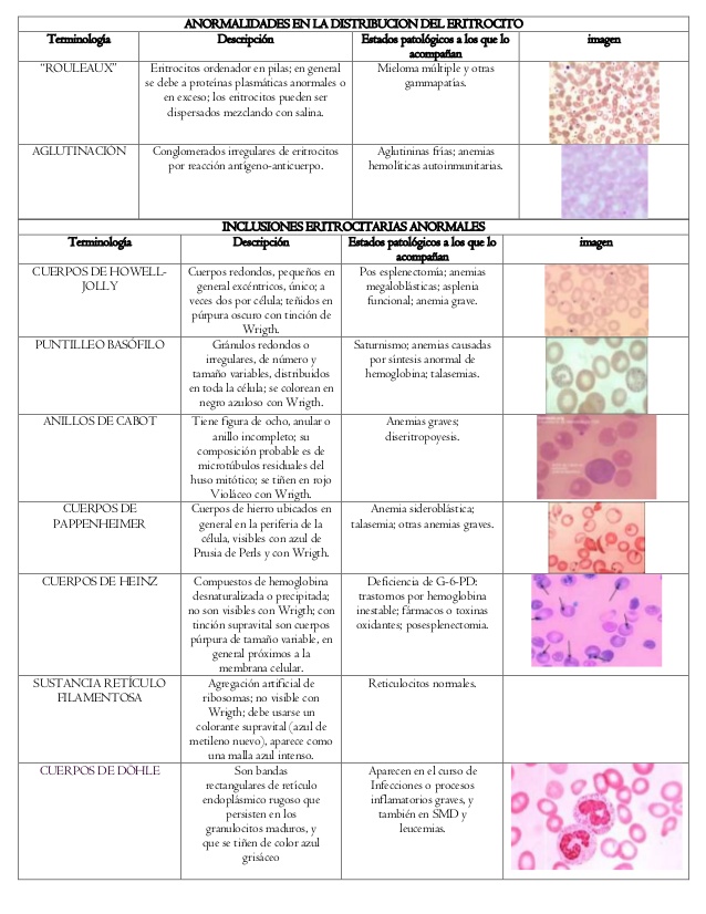 Laboratorista Clínico Majos: Anormalidades de los eritrocitos