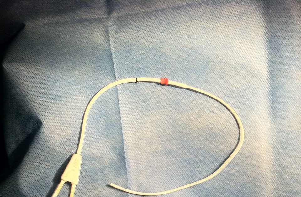 It Takes Villages: Farewell, Broviac