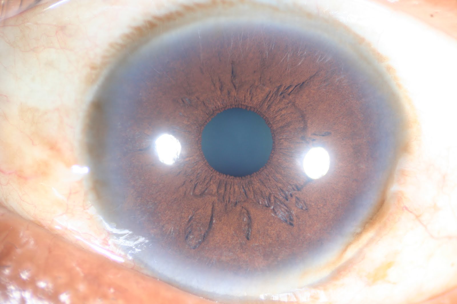 Modern & Multidimensional Iridology: Multidimensional Iridology ...