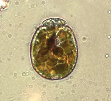 Pyrrophyta or fire algae (Dino Flagellata) | Domain Biologi