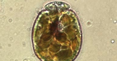 Pyrrophyta or fire algae (Dino Flagellata) | Domain Biologi