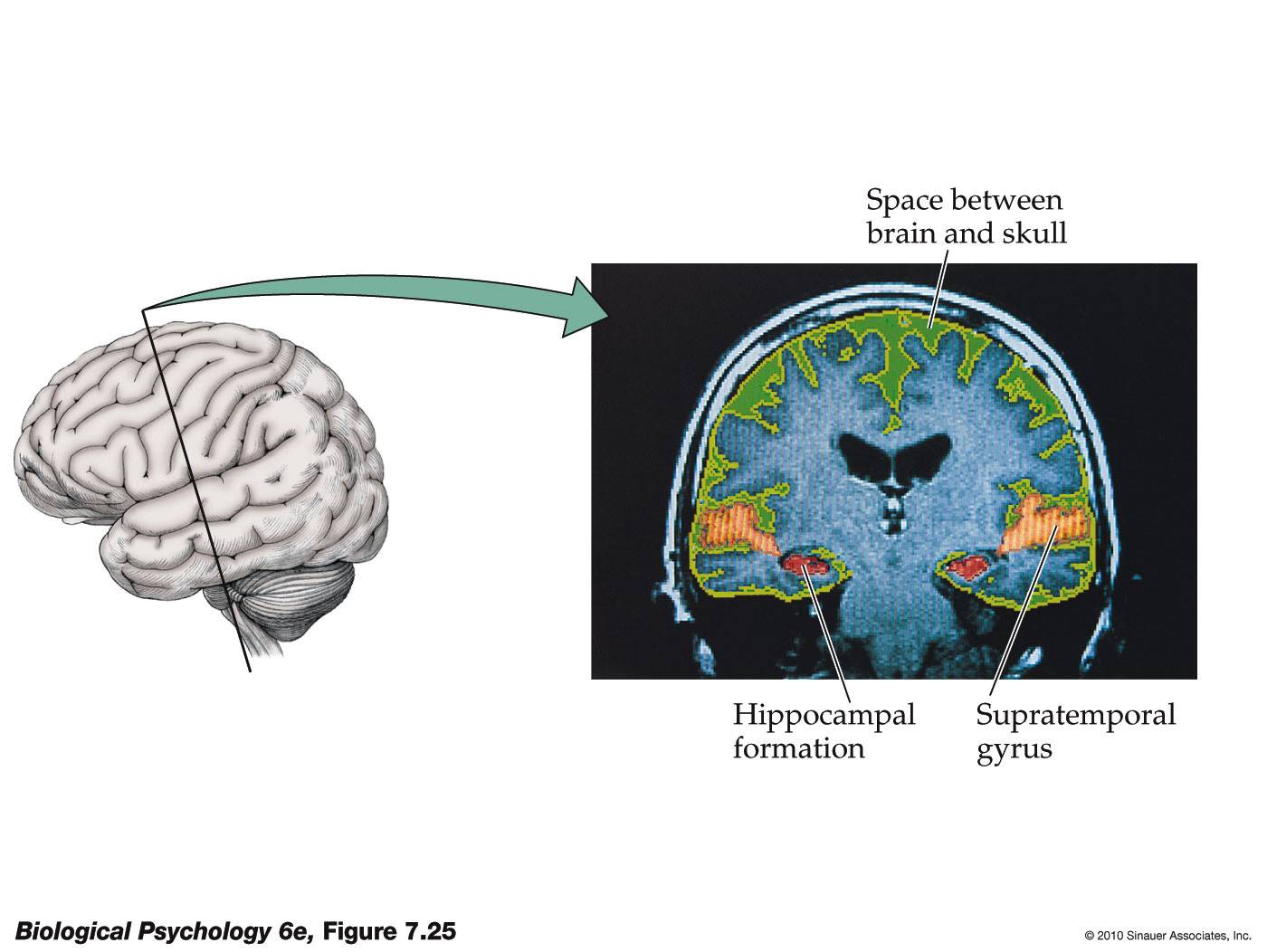 Life After Being A Student - My Mission To Learn: Neurological Diseases