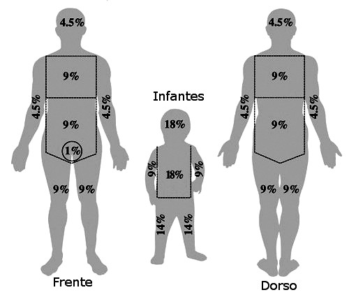 Paciente quemado y como tratarlo con la comida.