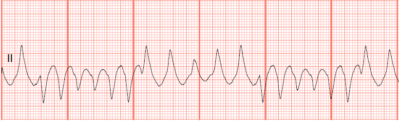 Basic EKG Test 71