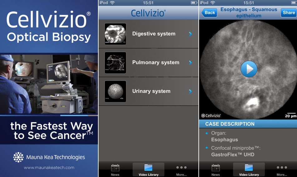Bouillons de Cultures: Cellvizio, le premier microscope endoscopique