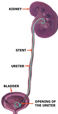 HEALTH FROM TRUSTED SOURCES: Laparoscopic renal surgery
