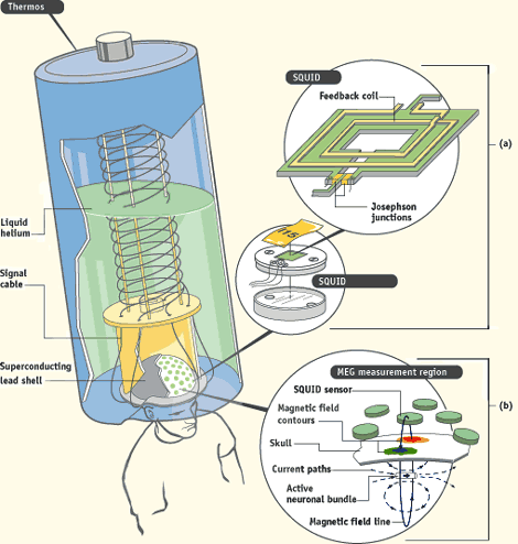 Quantum sensors are already here. Quantum technologies are all the hype ...