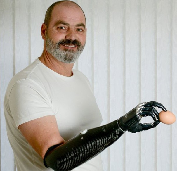-estrestopics.com: BBionic3, la mejor prótesis robótica para el brazo.