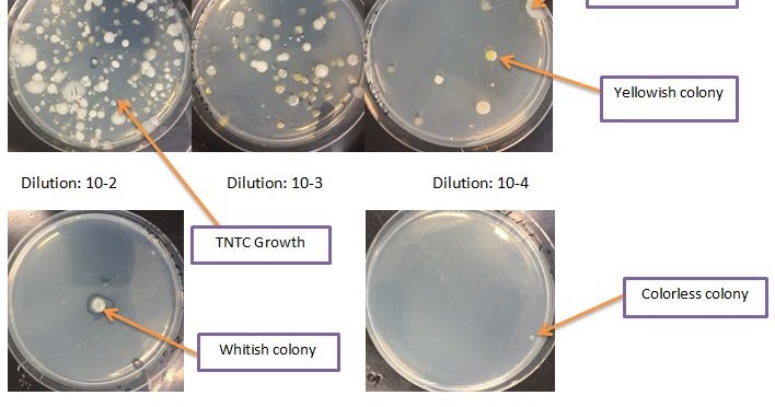 Isolation and Identification of microorganisms from soil sample ...