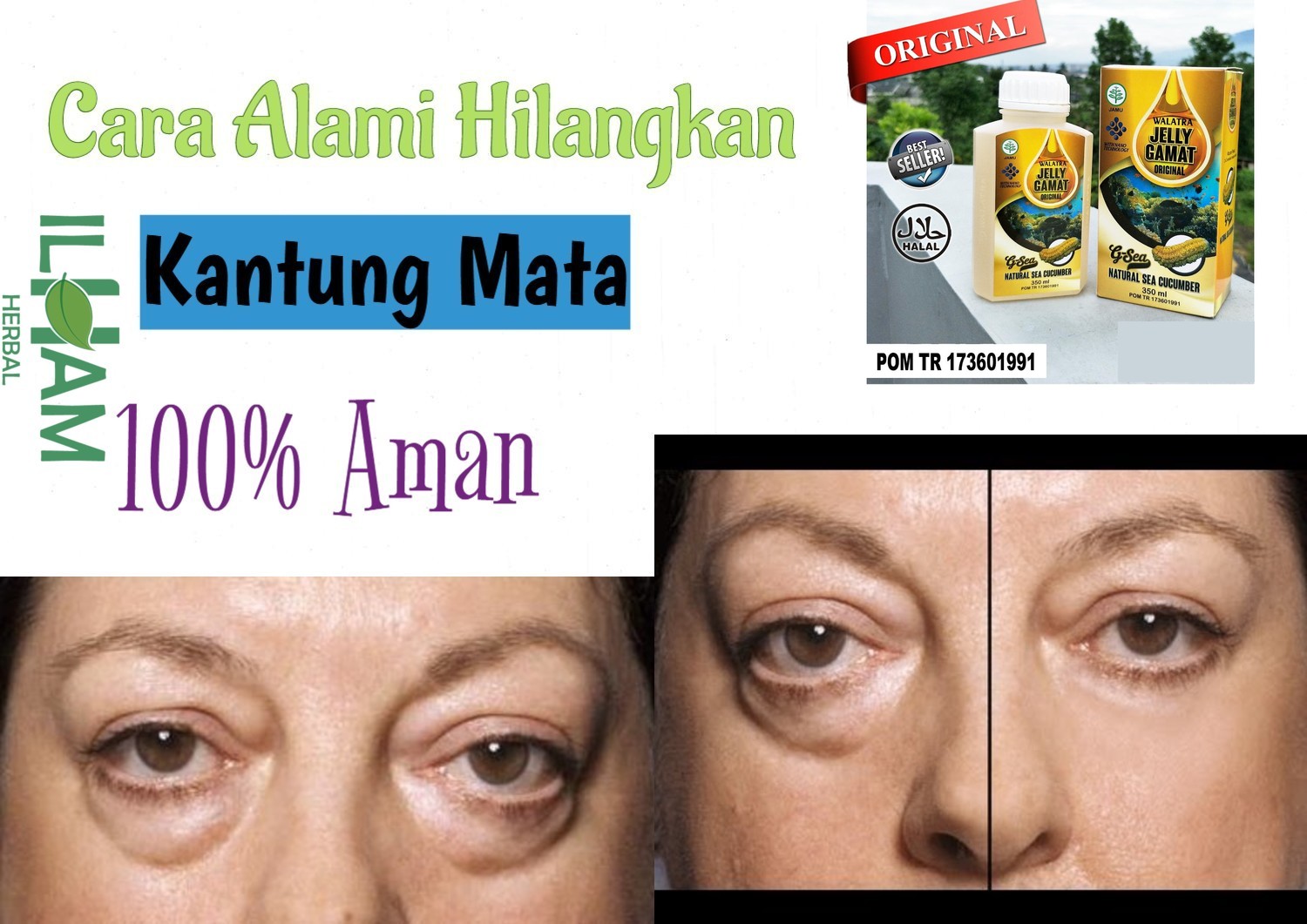 Tips Hilangkan Kantung Mata