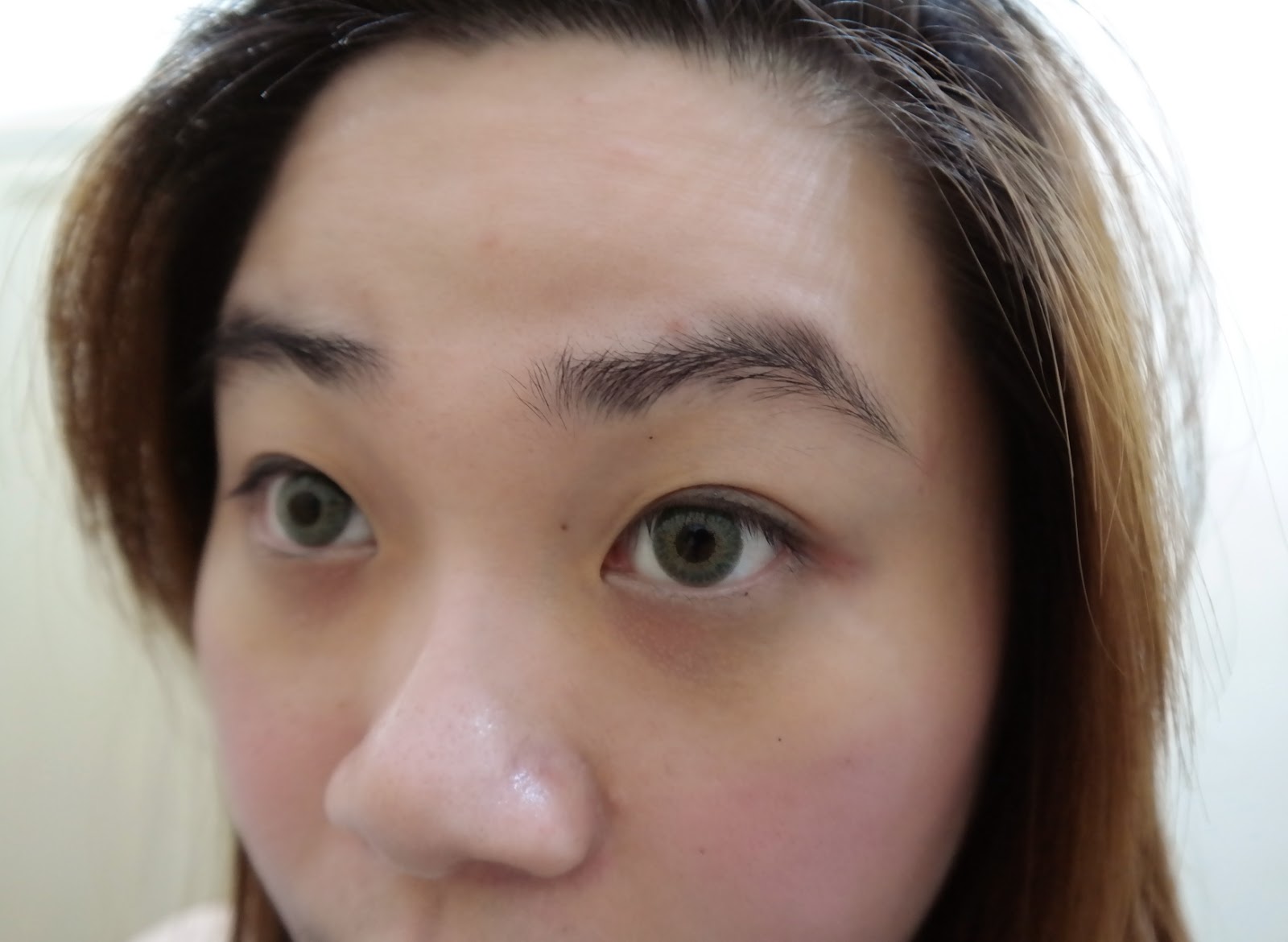 Miracle Aesthetic Clinic Tour & Eye Revitalizing Peel Review - Pink and ...