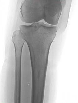 Bone Island - Sumer's Radiology Blog