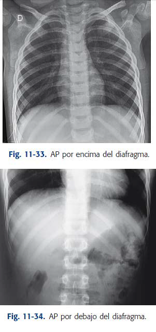 PRODUCCION Y TRATAMIENTO DE IMAGENES DIAGNOSTICAS: CAPITULO TÓRAX OSEO ...