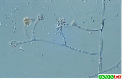 [Parasitology] Atlas of Medically Significant Fungi | Free Medical Atlas