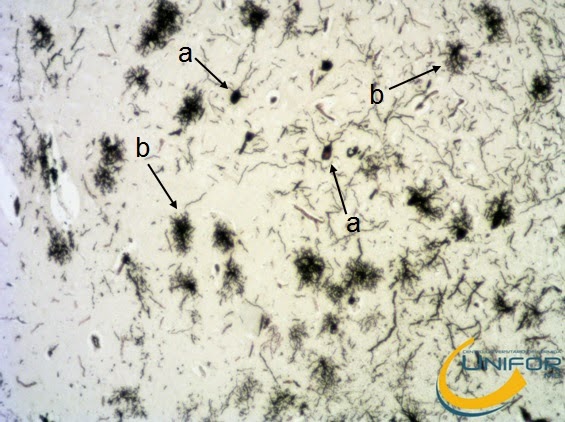 Atlas Histológico UNIFOR-MG: Astrócitos