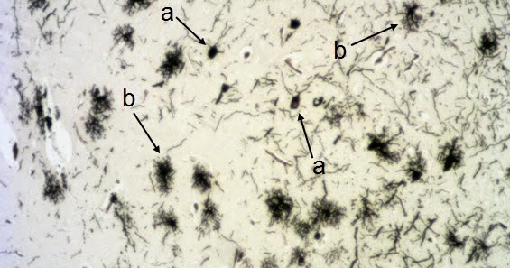 Atlas Histológico UNIFOR-MG: Astrócitos
