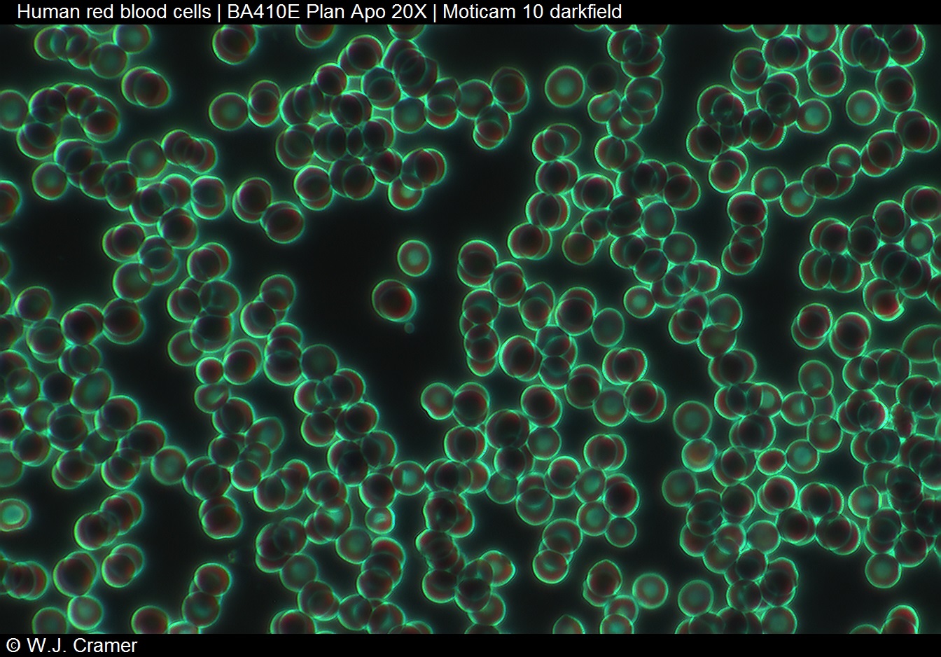 Red Blood Cells Light Microscope