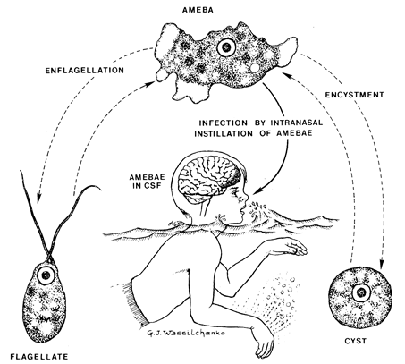 Scary Diseases: Naegleria Fowleri meningoencephalitis or the "brain ...