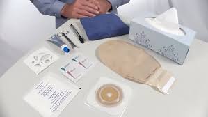 Ostomy Appliance | Basic Application of Ostomy Systems