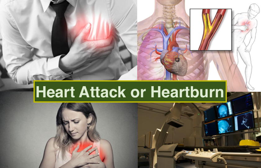 A heart attack is when there is a loss of blood supply to part of the ...