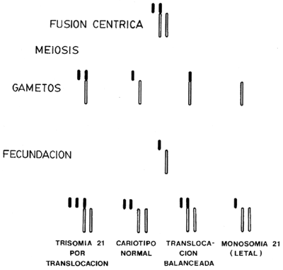 MONOSOMIA DEL 21: Causas