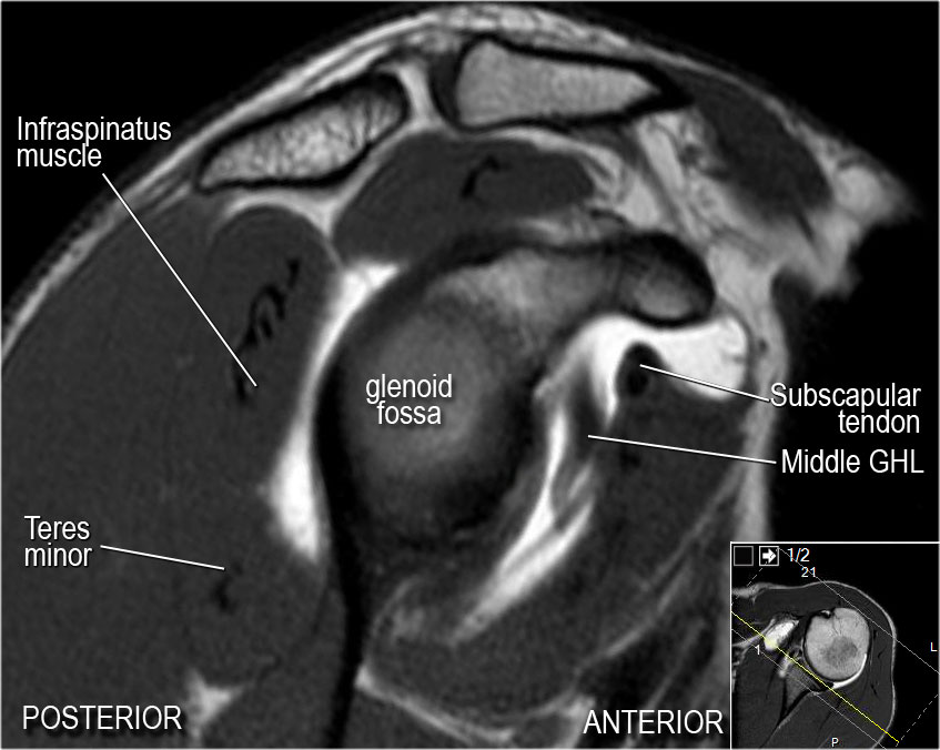 MRI Musculo-Skeletal Section: Sagittal anatomy and checklist