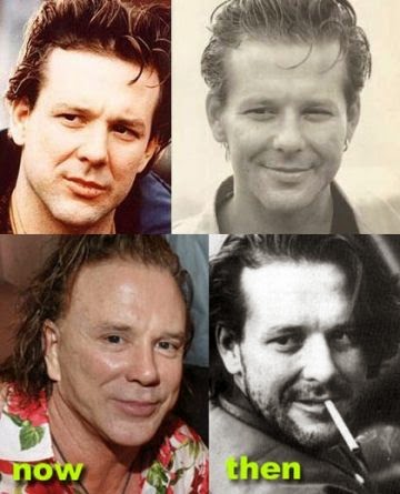 Mickey Rourke Face Plastic Surgery Gone Wrong Before and After Pictures
