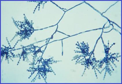 Fonsecaea Pedrosoi - FONSECAEA PEDROSOI PDF - Monophora are agents of ...