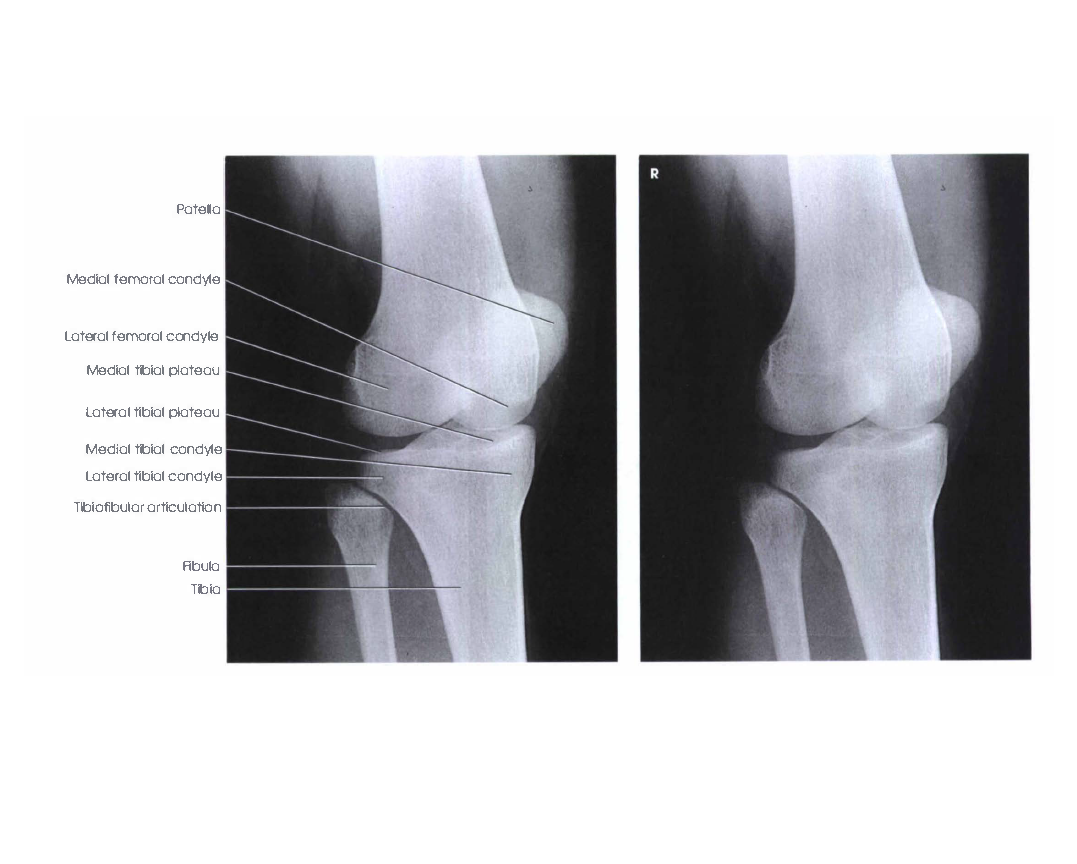 TEKNIK PEMERIKSAAN KNEE JOINT