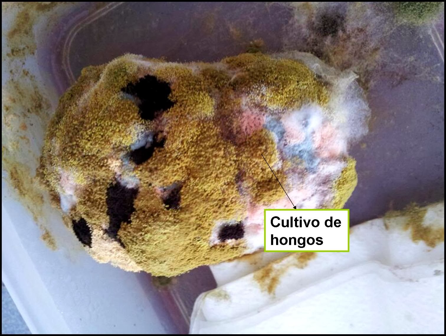 Biología humana: Análisis de hongos