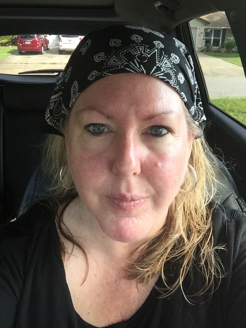 My Journey Through Topical Chemotherapy - Fluorouracil 5% Cream and ...