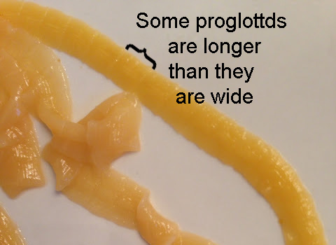 Tapeworm Proglottids In Human Stool