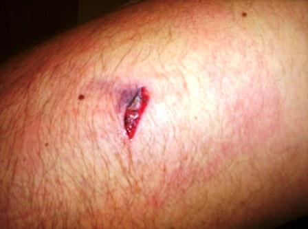 ER goldbook: Marine trauma and envenomation