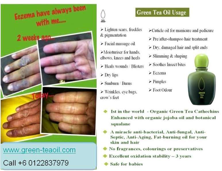 Skin care, Skin Treatment, Hair care: Skin Eczema solved with Green Tea ...