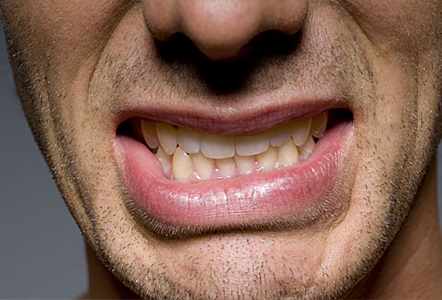 Dental Care: Are Daily Habits Damaging Your Teeth?