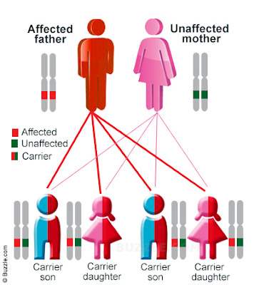 Medical Science Made Easy: Autosoml Recessive diseases at a glance