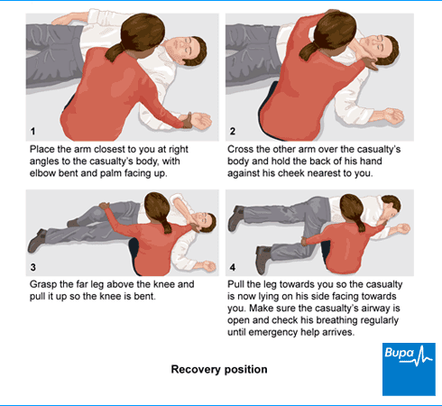 Pemberian Bantuan Hidup Dasar - Fadhila Alizza