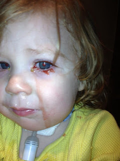 Zadie's Journey: Zadie's bloody eye