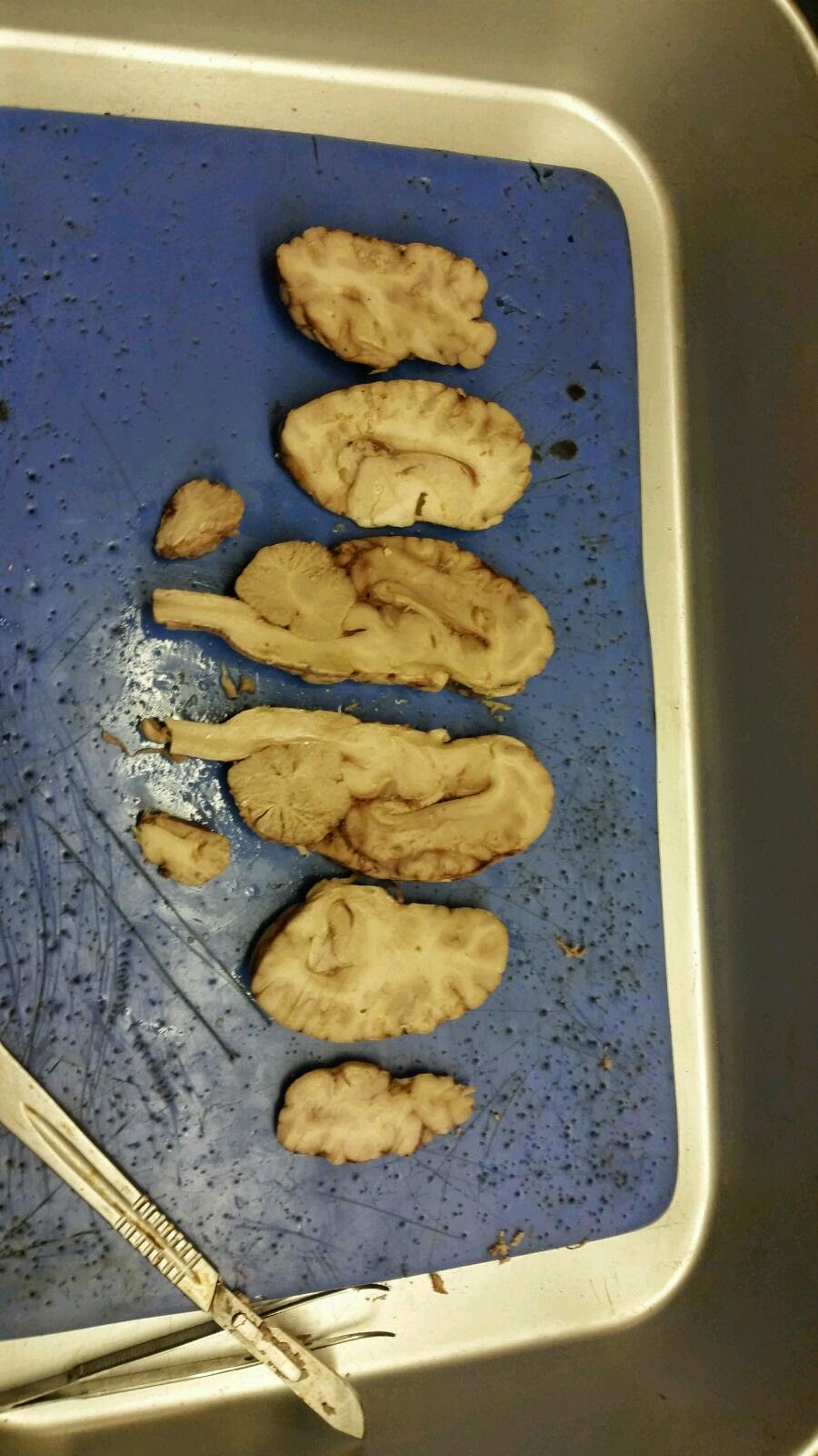 Anatomy and Physiology : Sheep Brain Dissection