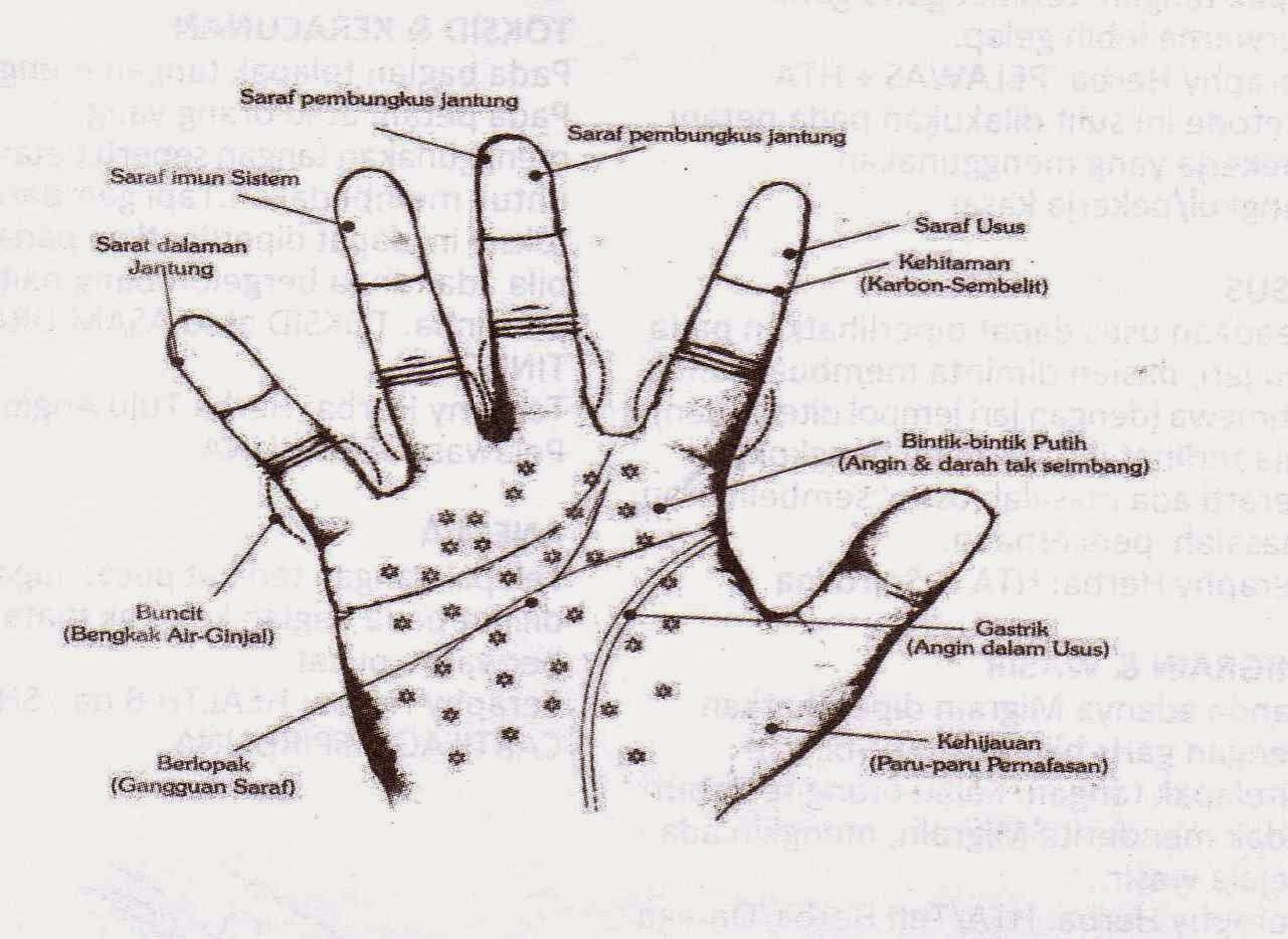 Rumah Sehat Al Syifa: Diagnosa Telapak Tangan (Sign Of Hand)