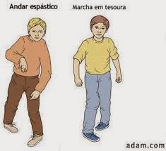 Blogão de Fisio: ANÁLISE DA MARCHA