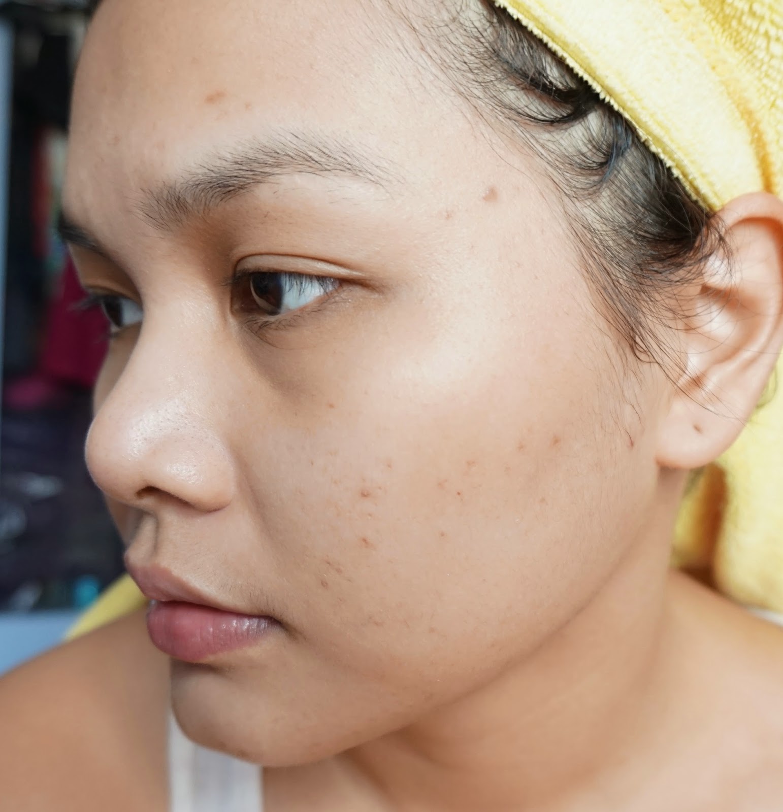 Yllume Ultimate Illuminating Complex Skin Care Review + Results | The ...