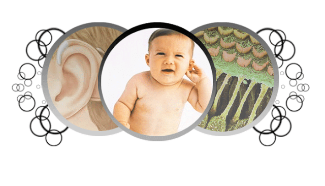 Hipoacusias | Otorrinolaringología