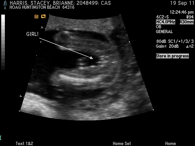 .: 2nd Trimester Ultrasound