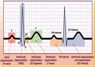 All about Medical Physics: EKG (Elektrokardiogram)