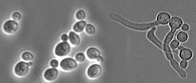 el Hallazgo: Tipos de cándida